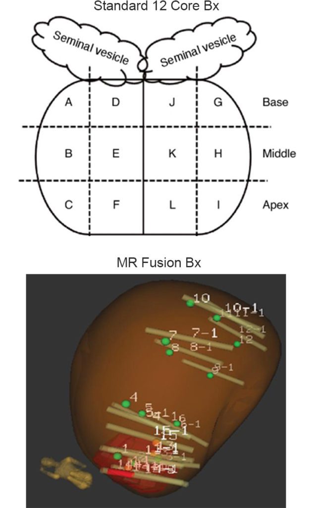 MRI Fusion | Wasatch Medical Specialties